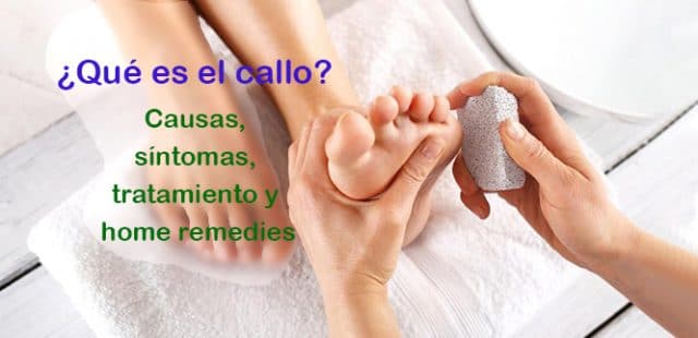 ¿Qué es el callo? Causas, síntomas, tratamiento y home remedies