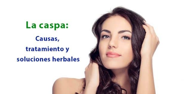 La caspa: Causas, tratamiento y soluciones herbales