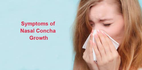 What are the causes of Nasal Concha Growth? Symptoms and treatment